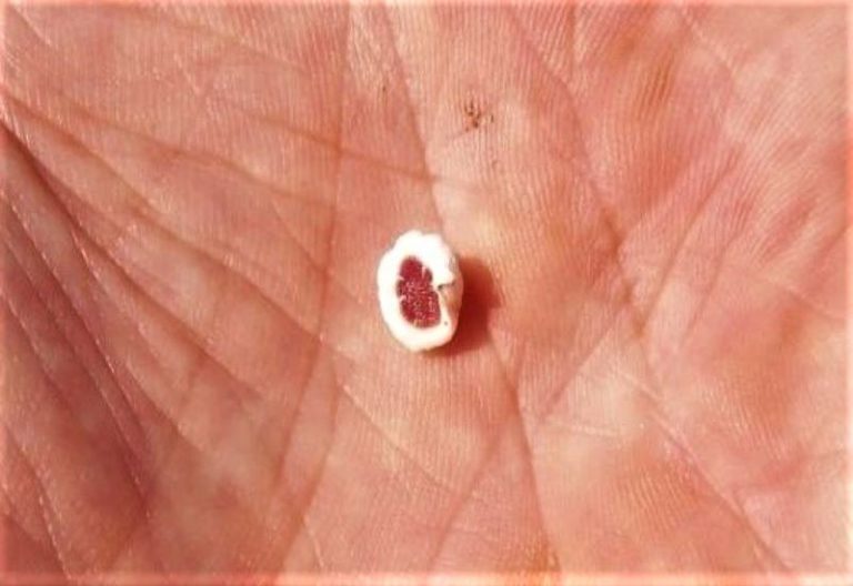 Some Key Soft Scale Pests in the Landscape — Plant & Pest Advisory